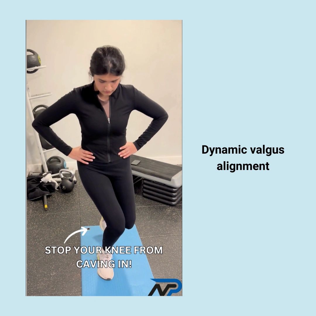 Pain to Performance: Understanding IT Band Syndrome | Nottingham Physio