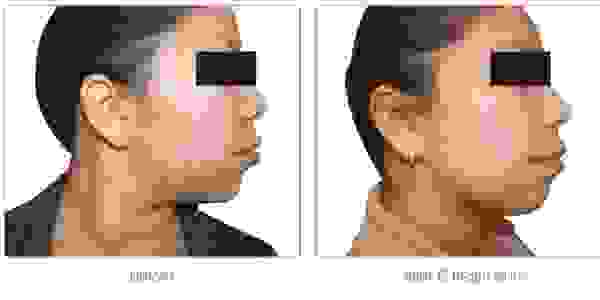 Medical Spa | Auburn Primary Care and Aesthetics