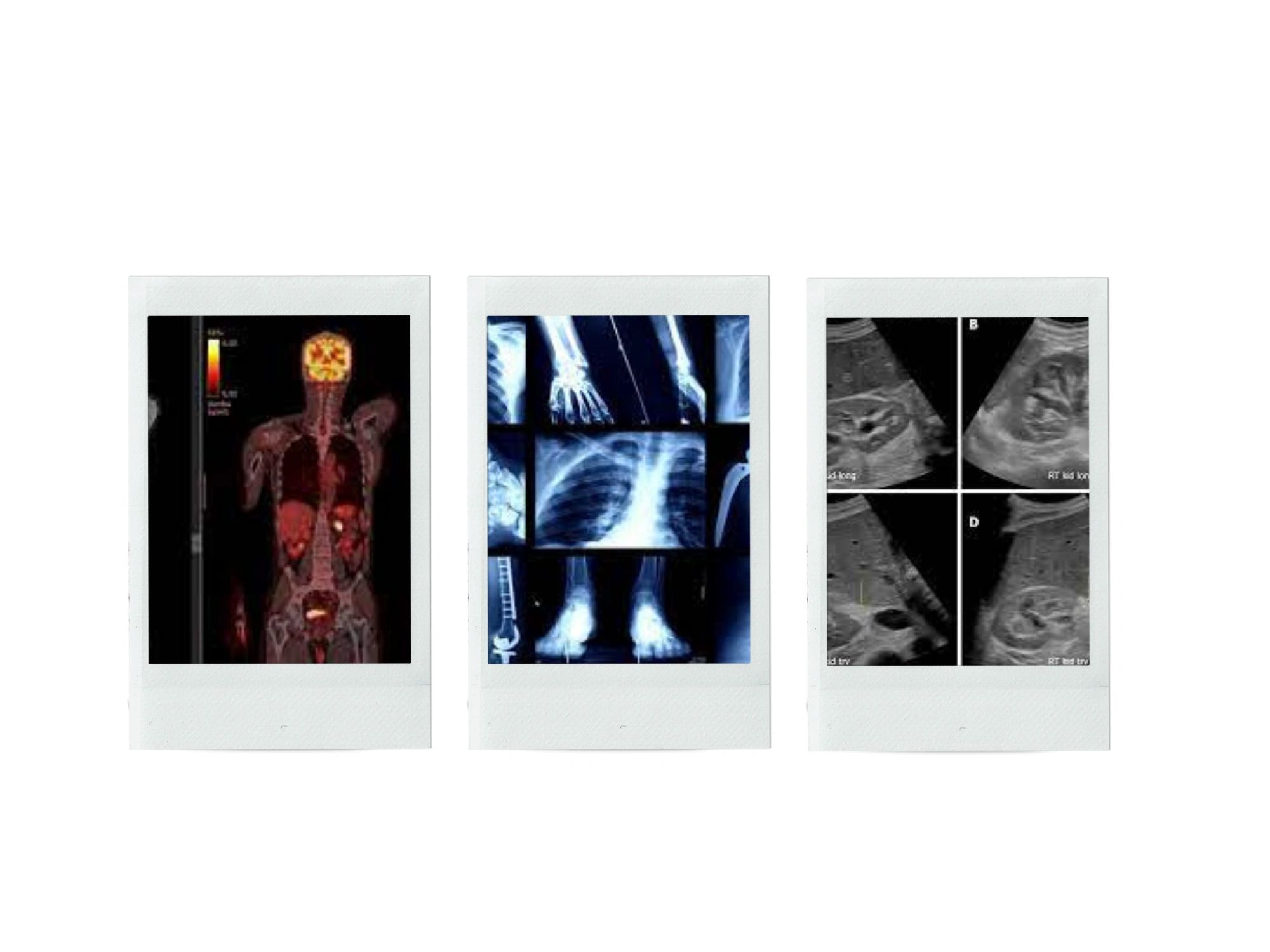 Transparent Imaging