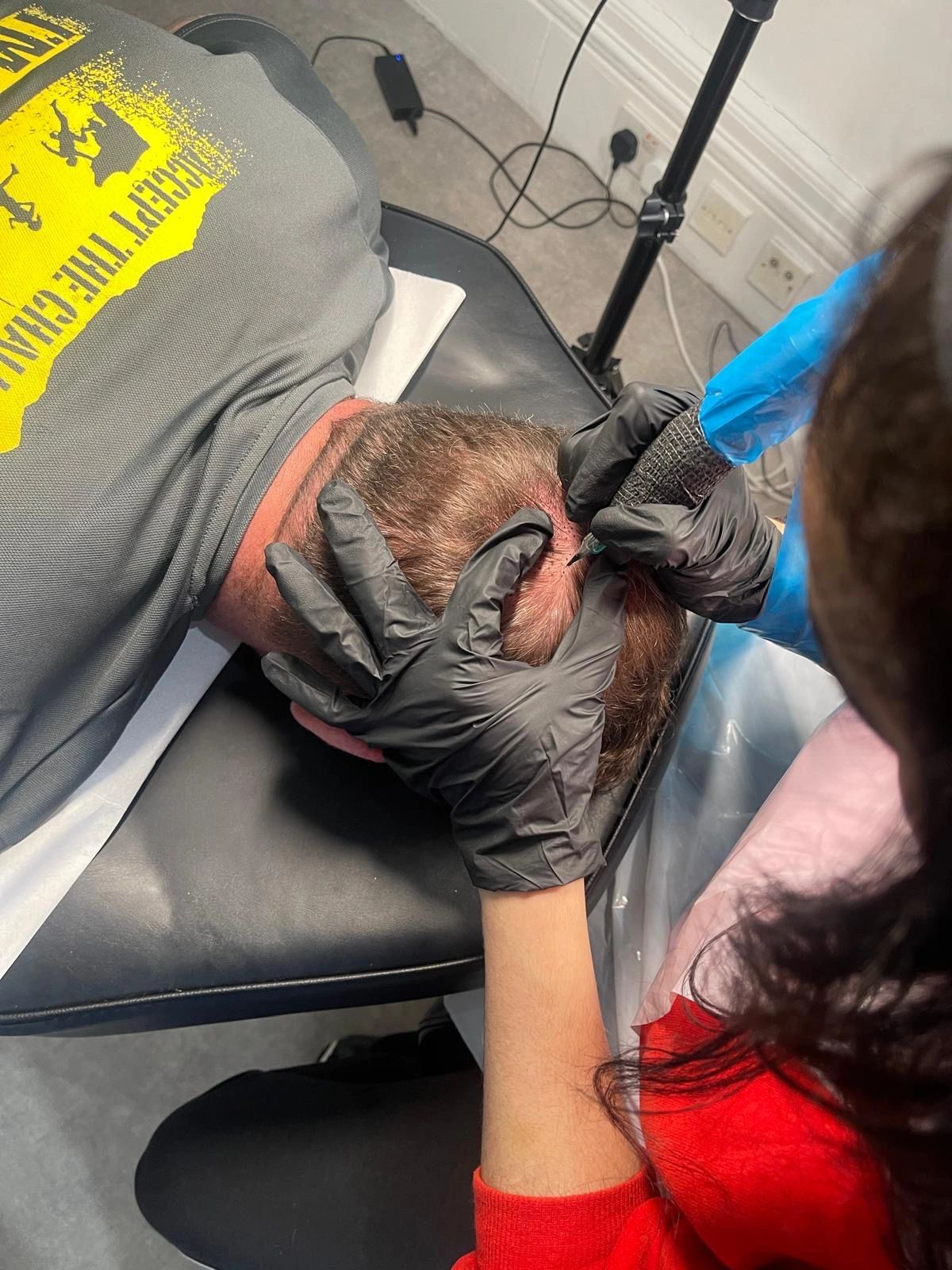 Hair & Repair | Scalp Micropigmentation