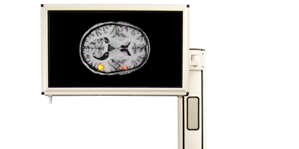 GAZE INTELLIGENCE - MRI Monitors, MRI Patient Monitors | GAZE INTELLIGENCE