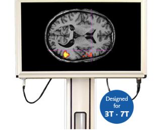 GAZE INTELLIGENCE - MRI Monitor, MRI Monitors, MRI Patient Monitors ...