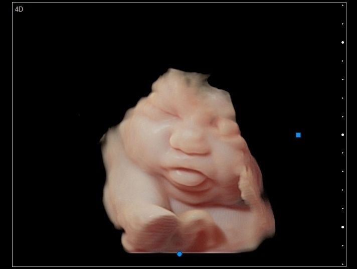 When is the Best Time to Get 3D Face Pictures of the Baby?