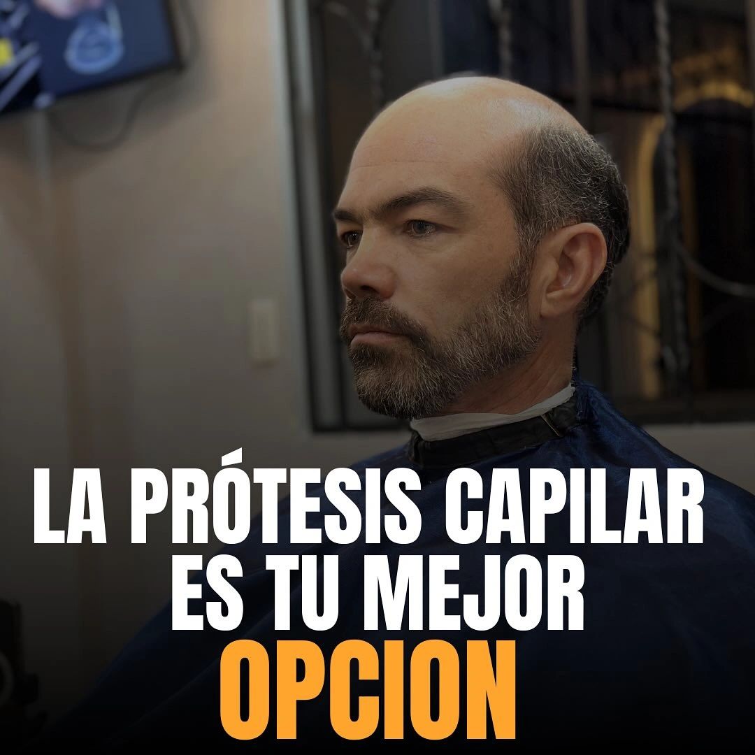 El Bigoton - Protesis Capilares, Protesis Capilares