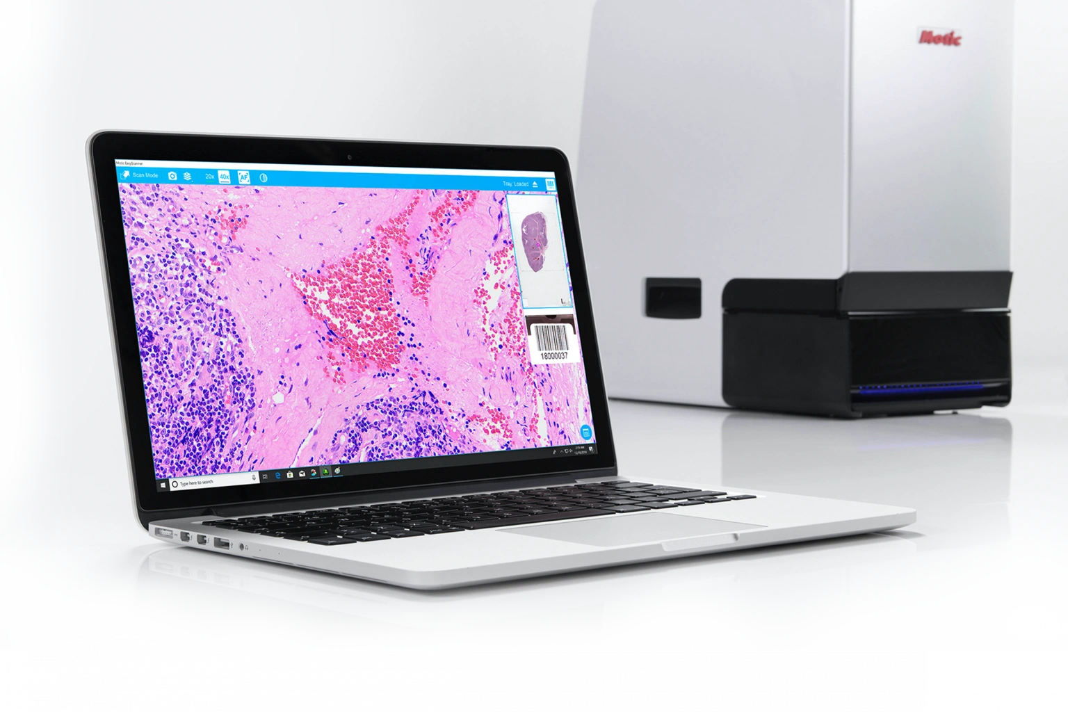 Get Cancer Answers with Apollo Digital Pathology