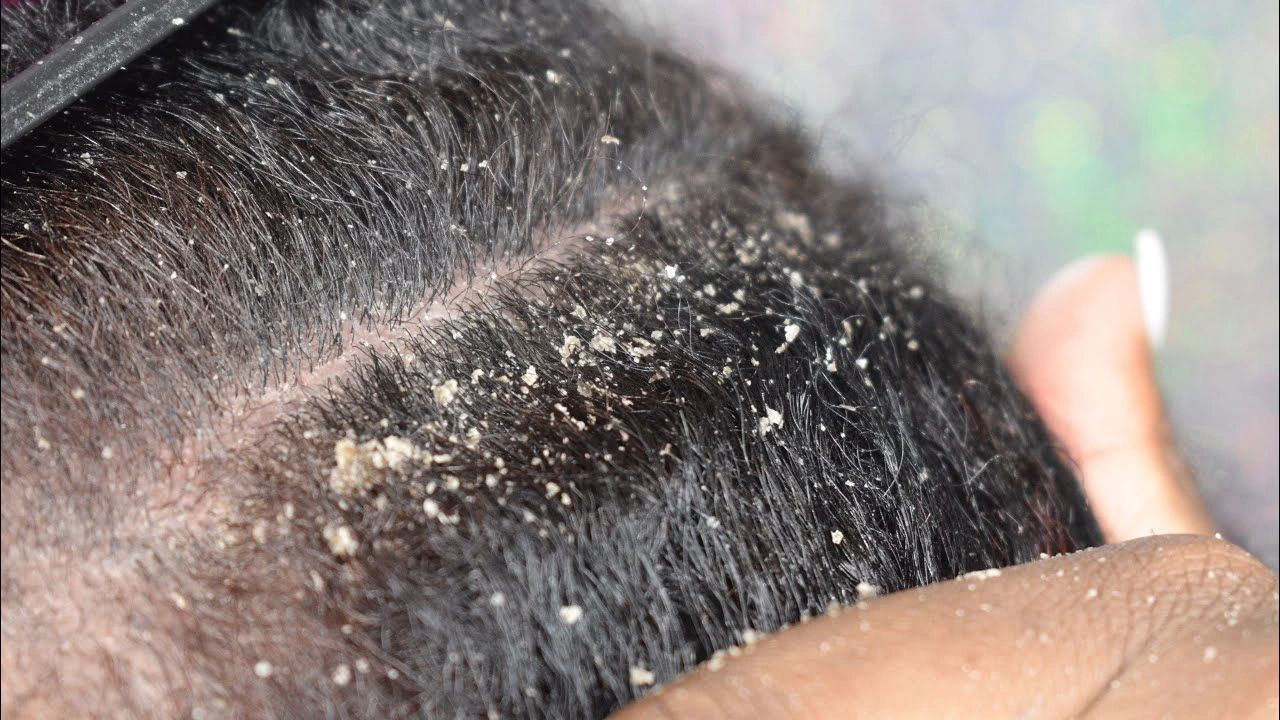 Creating A Healthy Environment For Your Hair To Thrive.