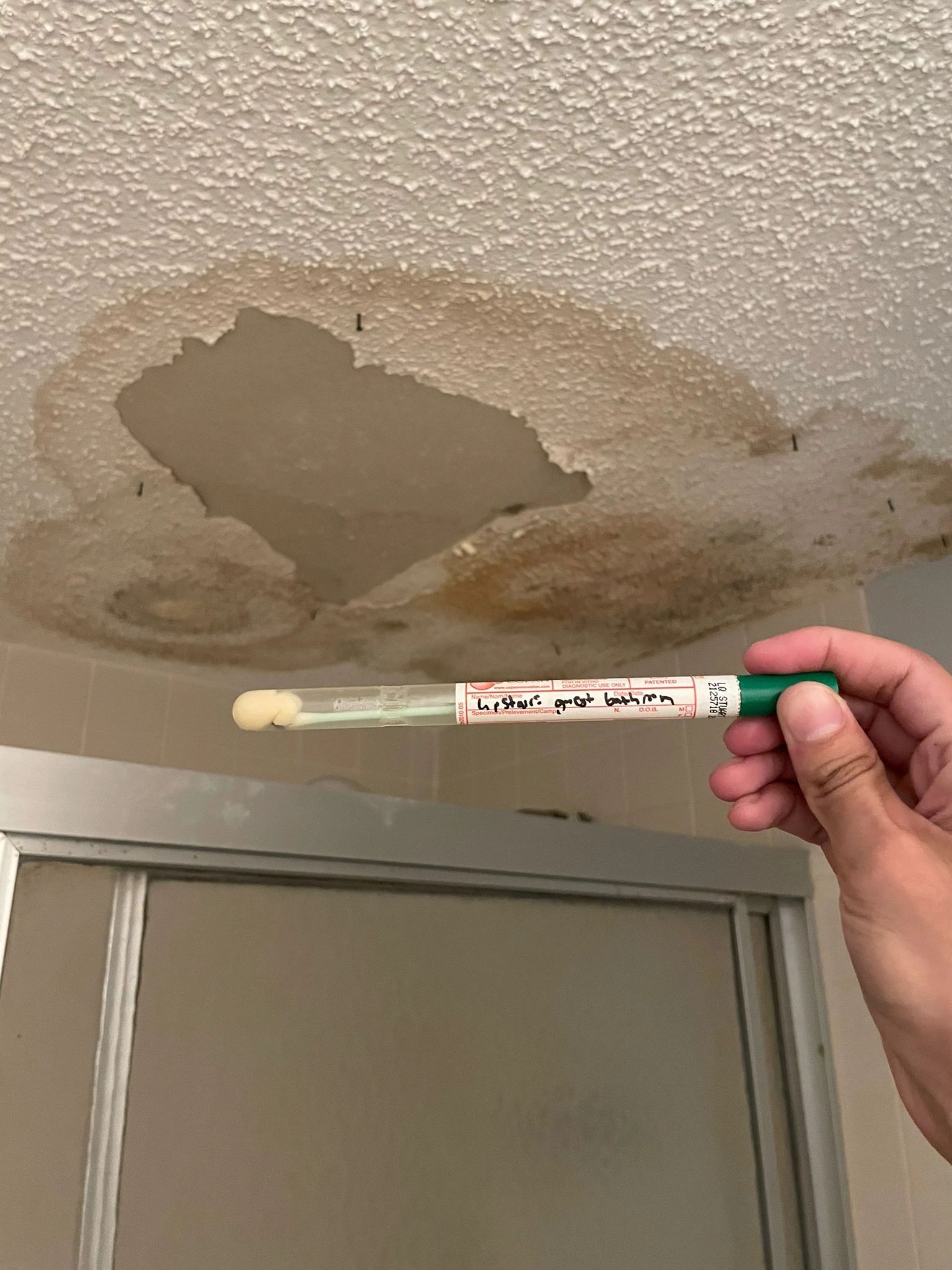 Mold Exposure: Signs, Symptoms, and How to Recognize Them