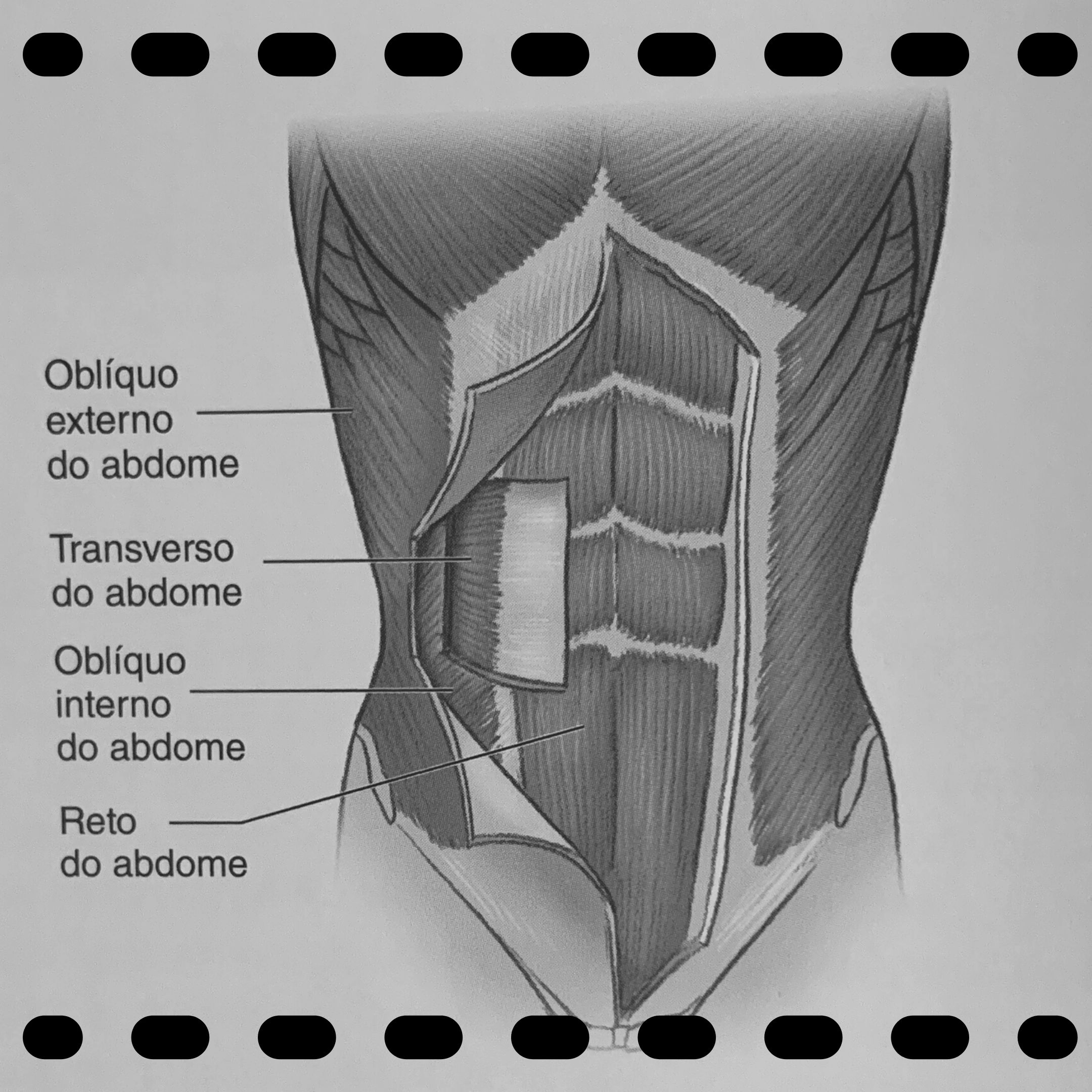 Oblíquo Externo Do Abdome - RETOEDU