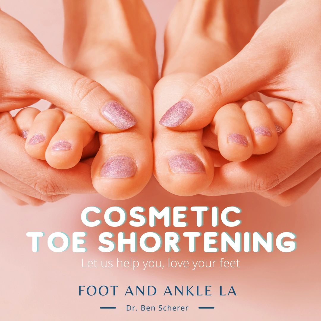Toe Shortening Surgery: Enhancing Comfort and Confidence