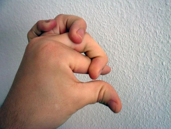 About | Florida Keys Ehlers Danlos Society