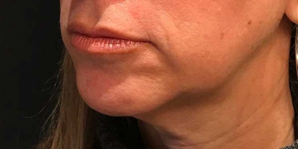 Glow Medical Aesthetics