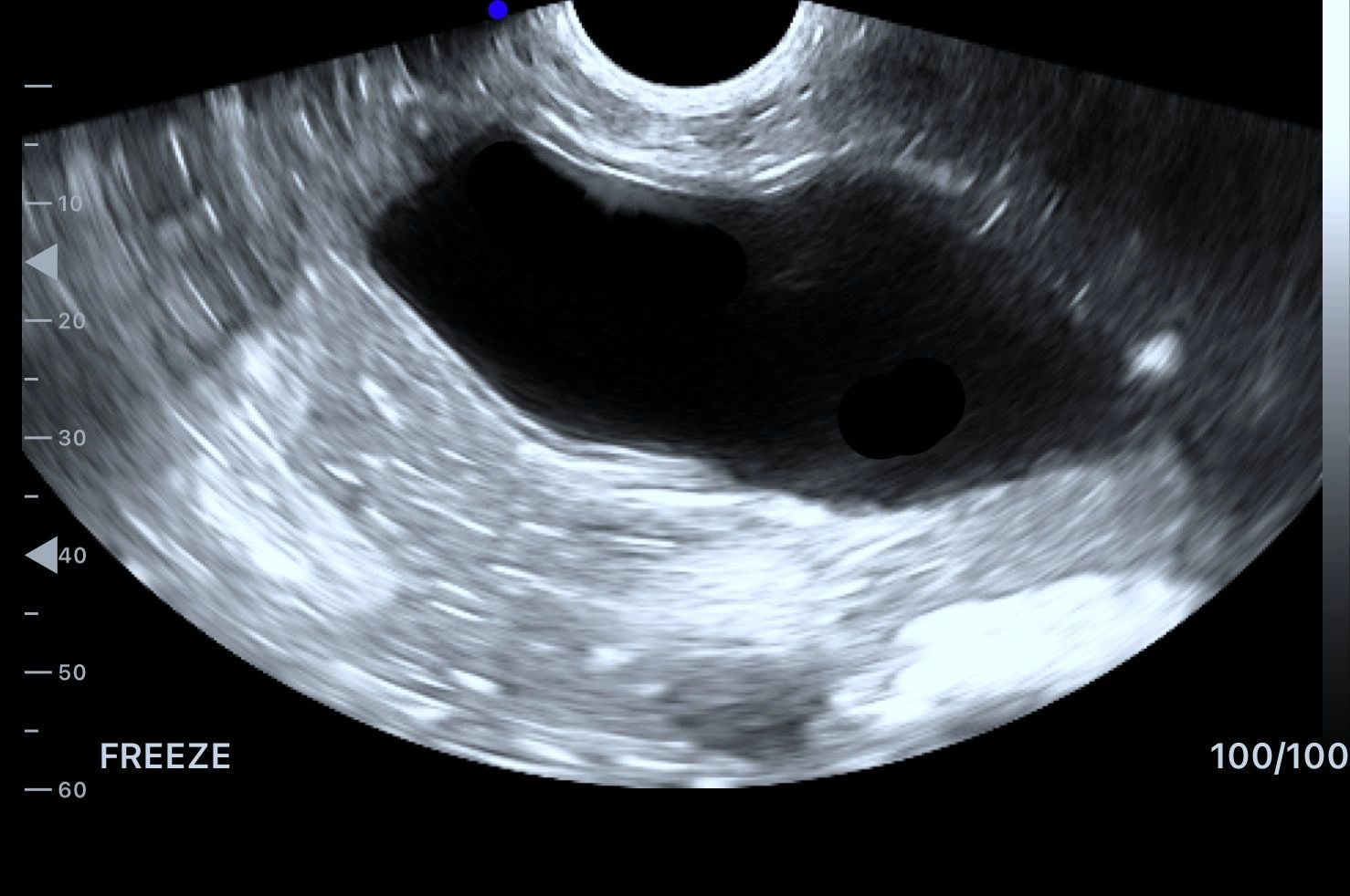 Veterinary Definition Of Cystocentesis at Eileen Marvin blog
