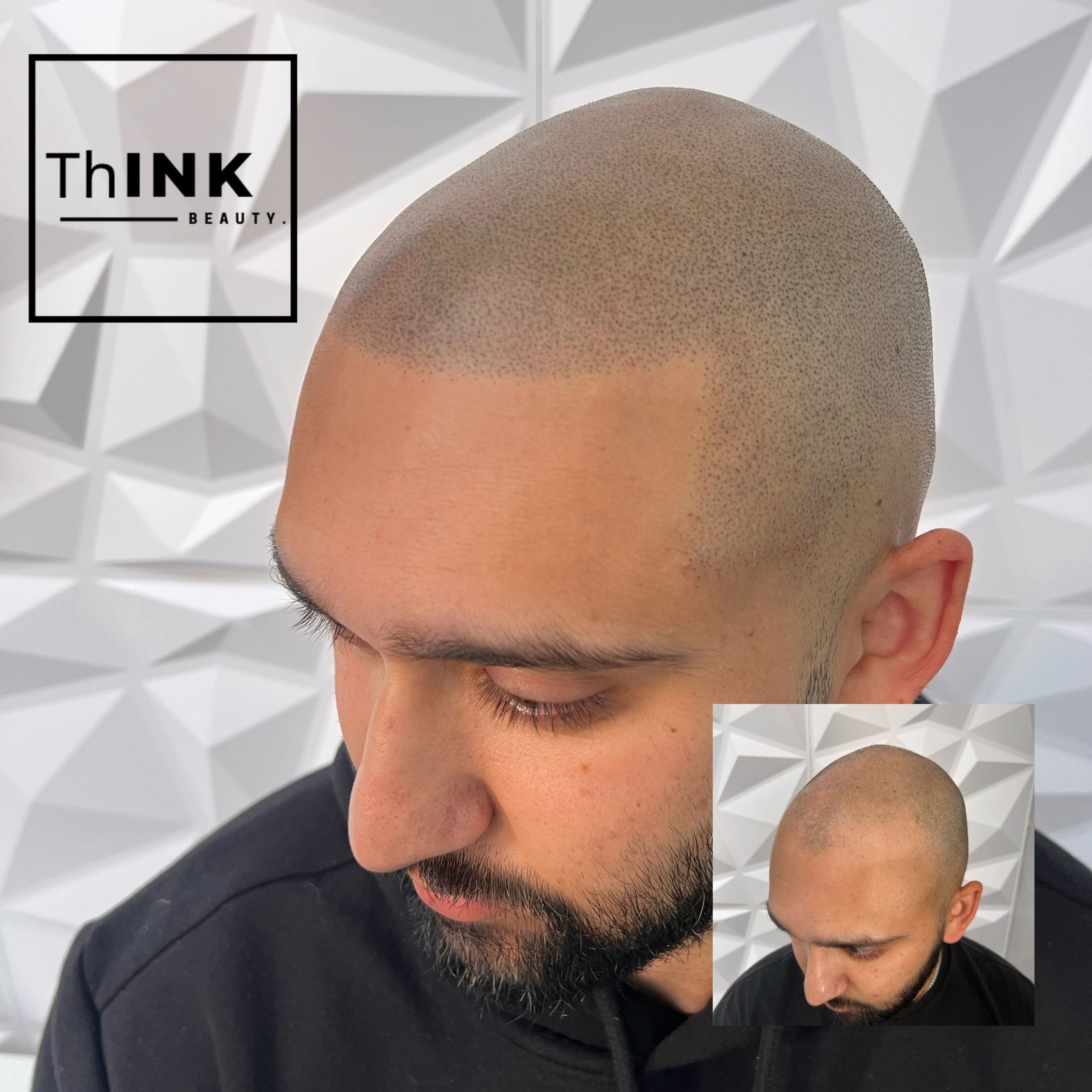 Transform Your Look with Permanent Makeup Services at ThINK Beauty