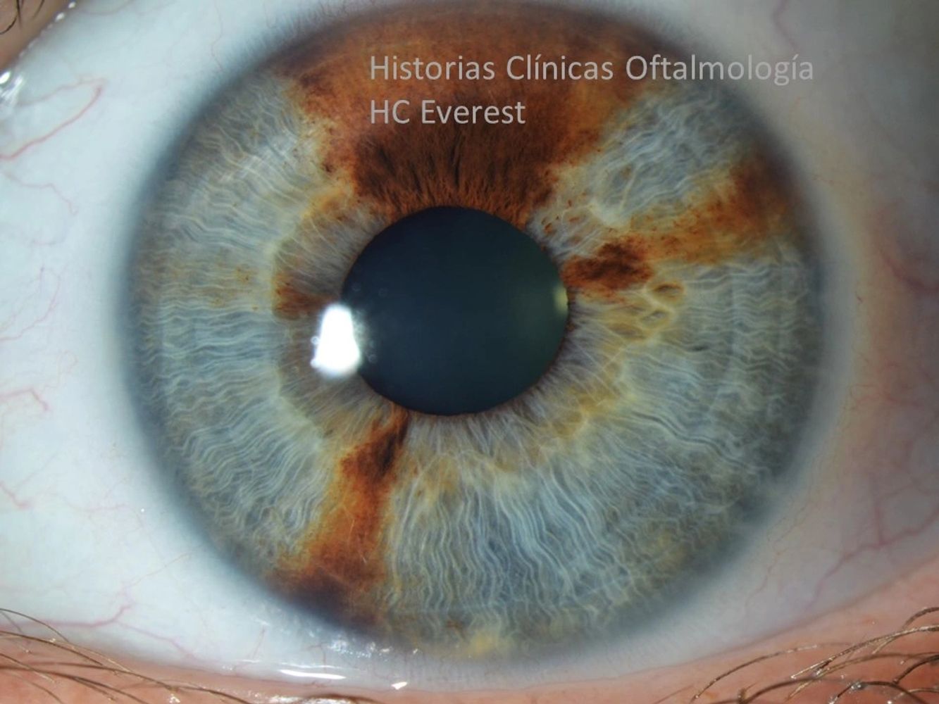 HC Everest, Historias Clínicas Oftalmología
