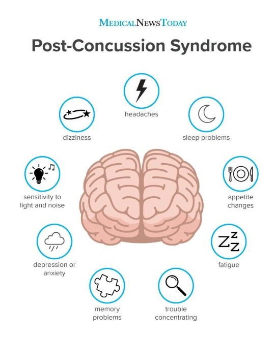 Concussions and Balance: Symptoms and Associated Treatment