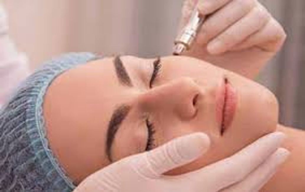 Microdermabrasion | skin 360