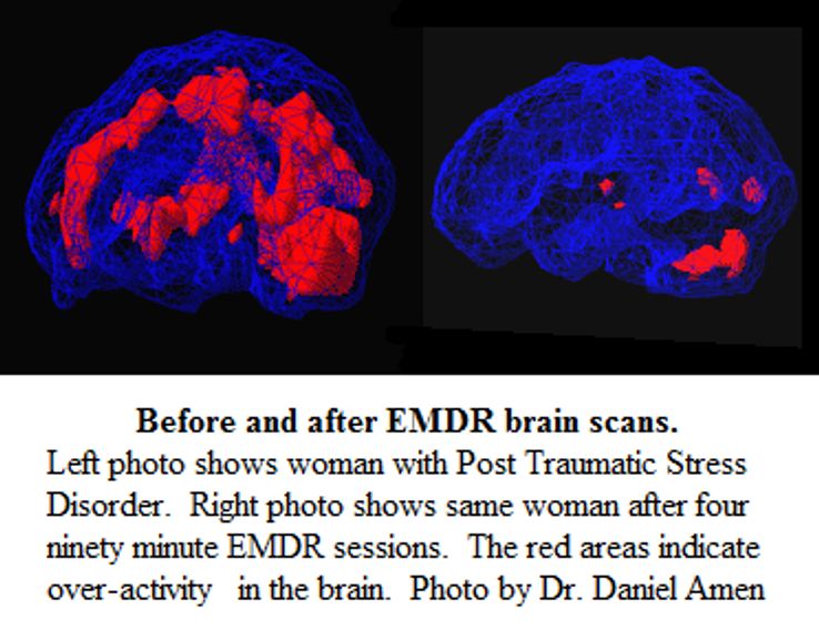 EMDR | Sex Therapy & Couples Counseling