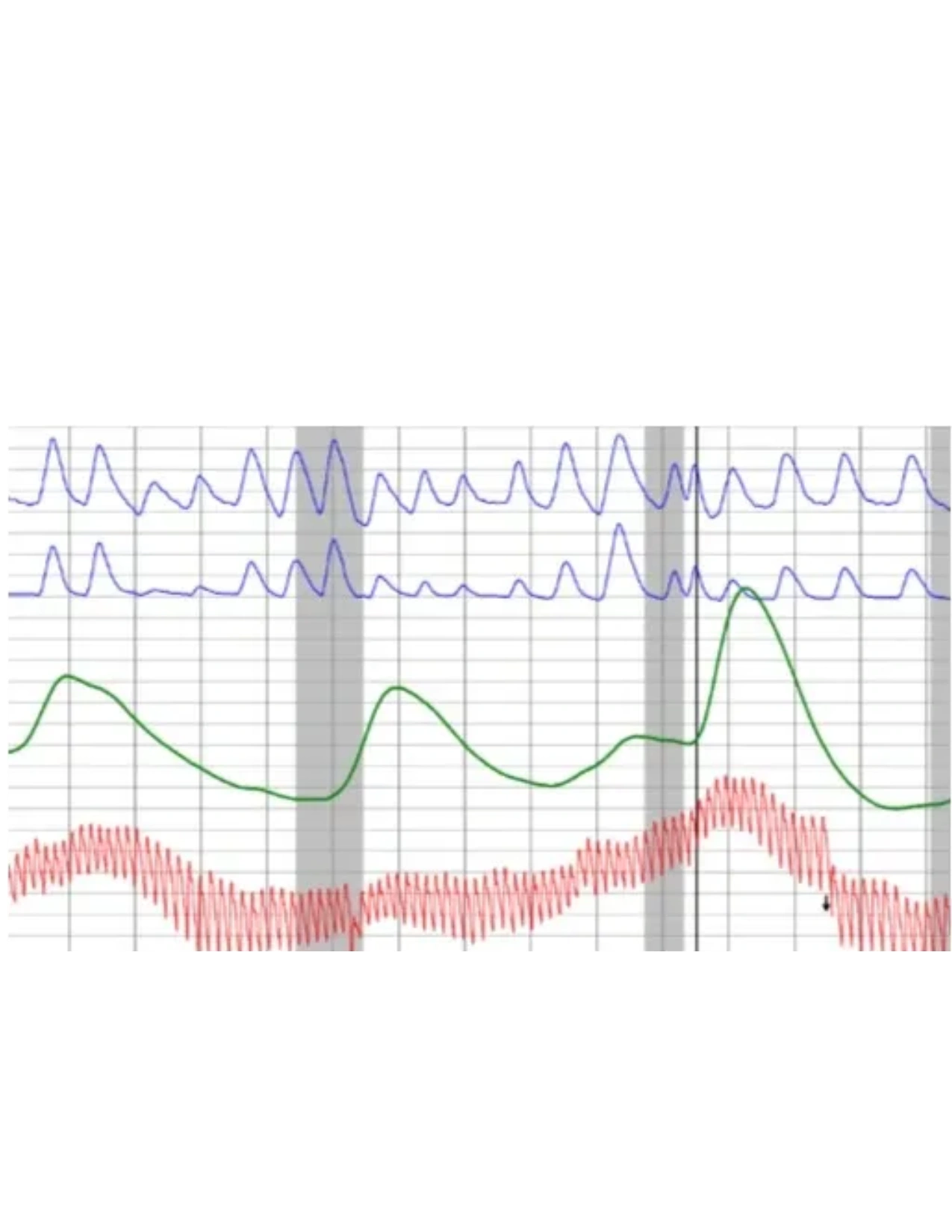 Professional Polygraph Testing Services