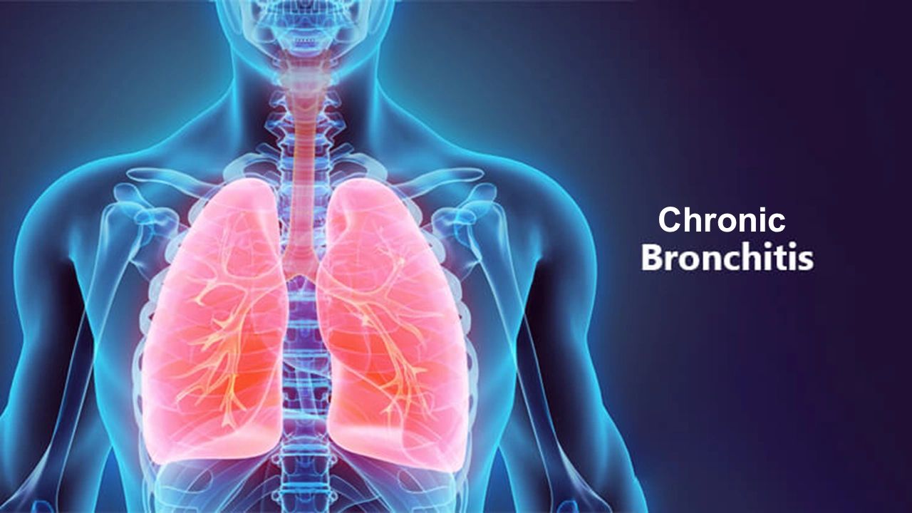 Breathing easy: Quantum Biofeedback for Chronic Bronchitis Relief