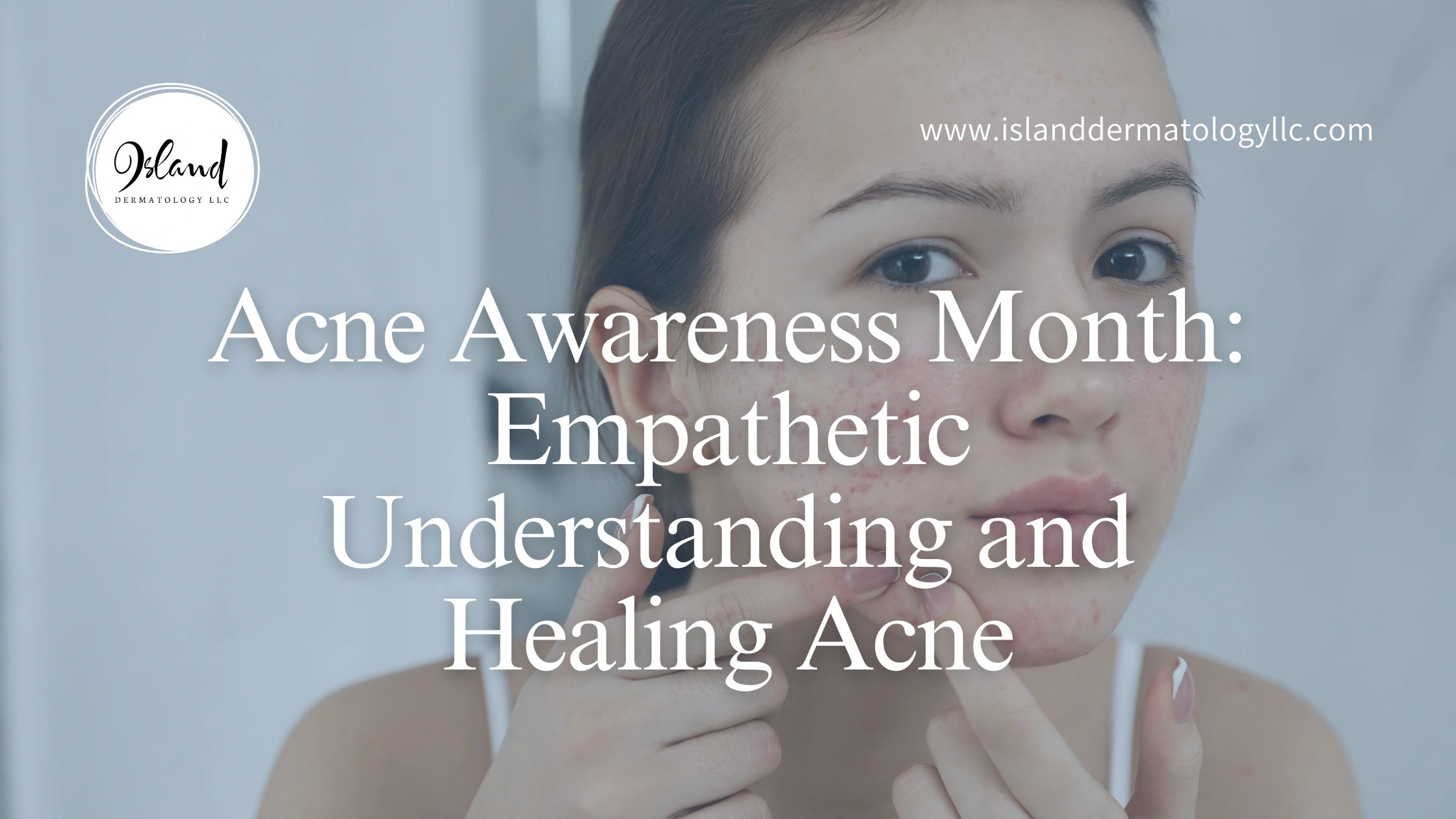 Acne Awareness Month: Empathetic Understanding and Healing Acne