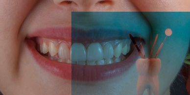 DENTAL HYGIENE SERVICE