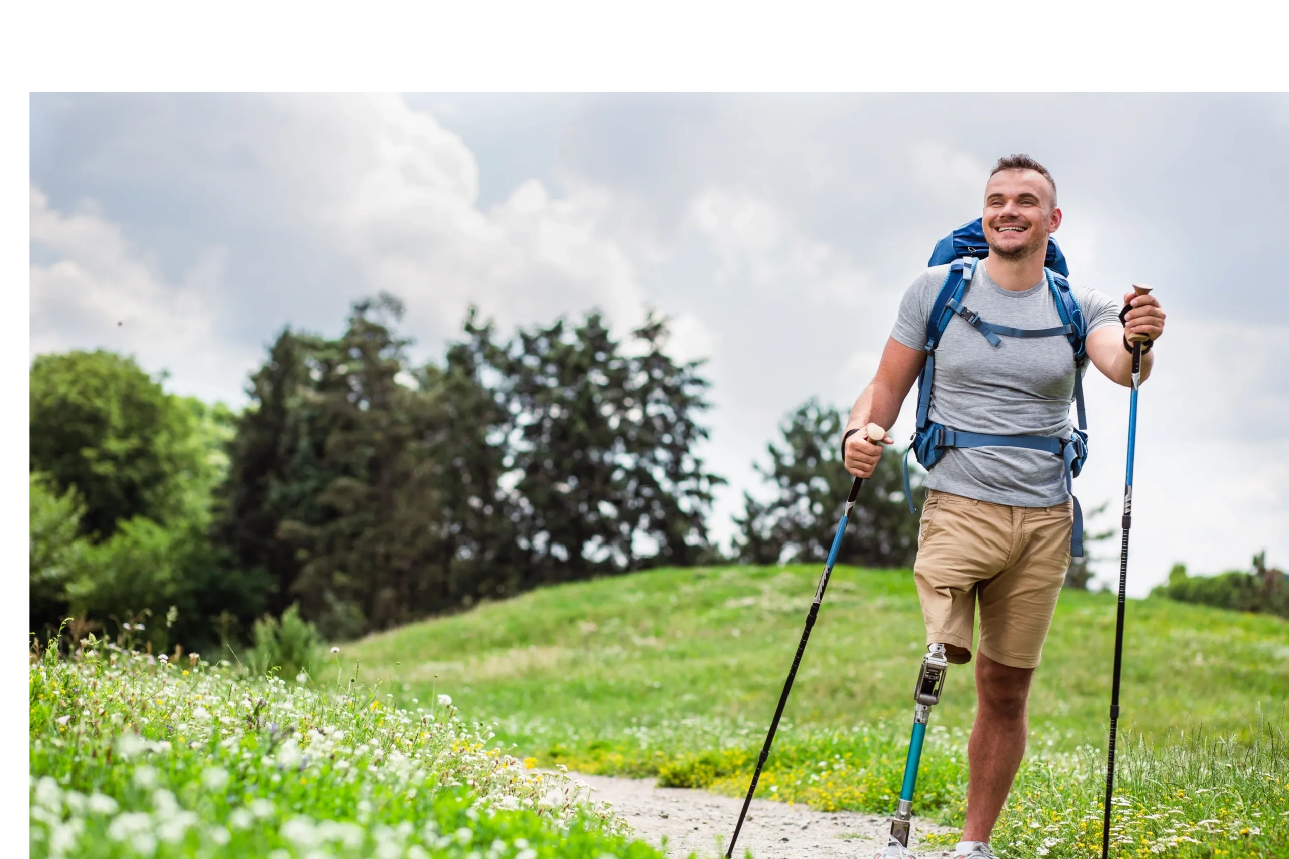 Adjustable Sockets | 865 Prosthetics