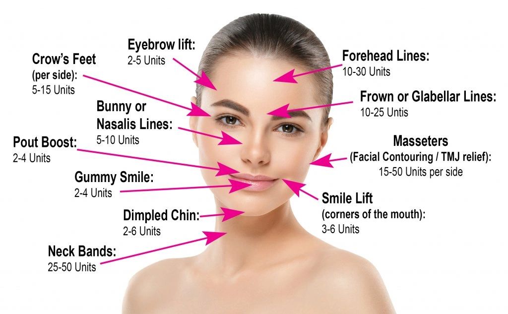 How Much Botox 