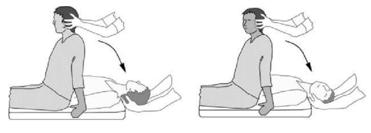 How do I treat benign paroxysmal positional vertigo at home?