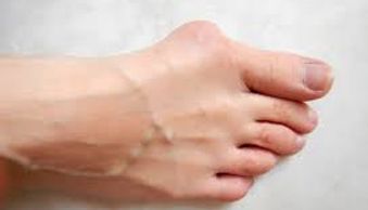 Midlothian Foot Care - Podiatry, Foot Pain, Corns, Bunion