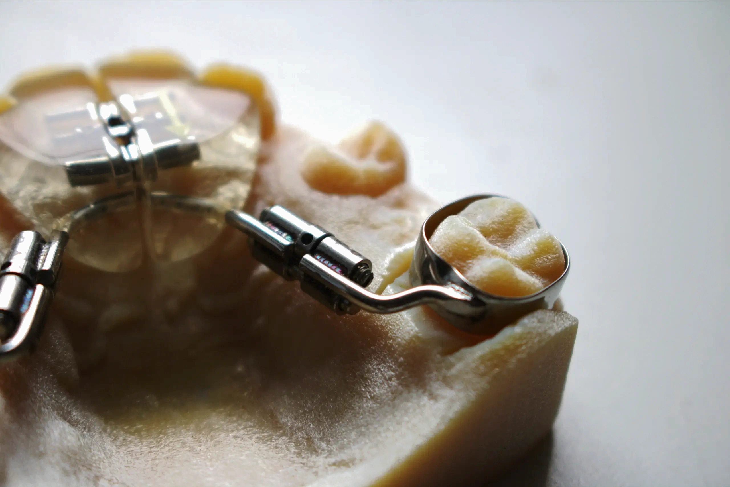 Next Level Orthodontic Lab