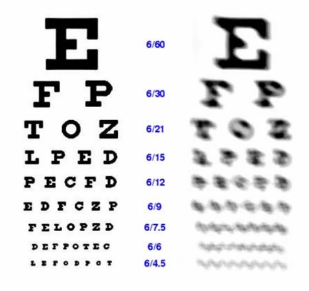What is Astigmatism?