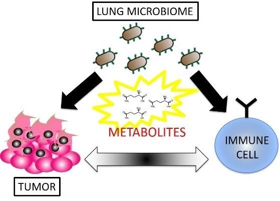 Characterization of Metabolic Signatures in Patients with Lung Ca