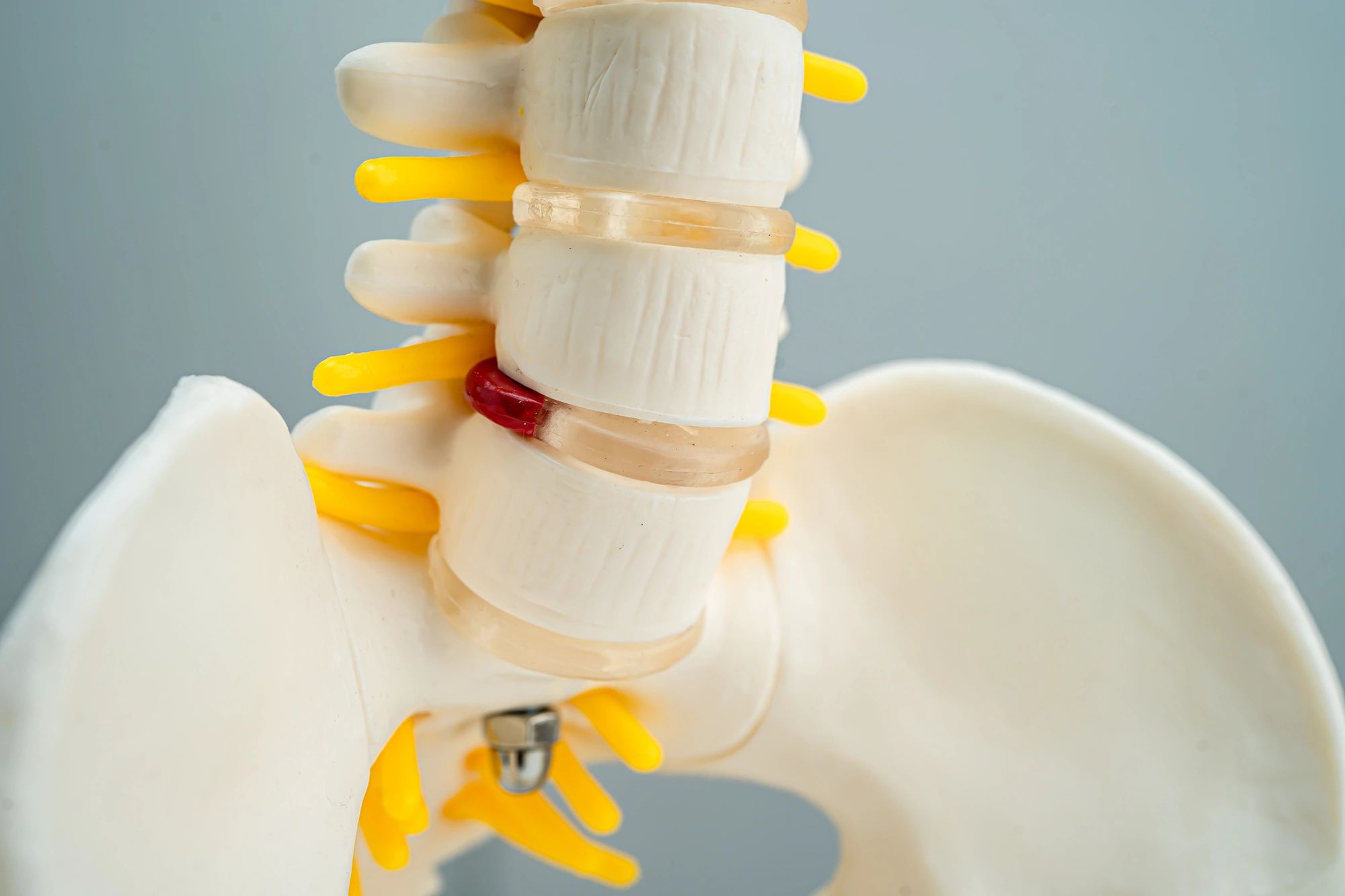 Healing Properties for Degenerated Disc and Cartilage