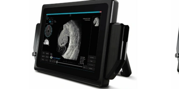 2M Eye Instruments - Ophthalmic Ultrasounds, Pachymeters | 2M Eye ...