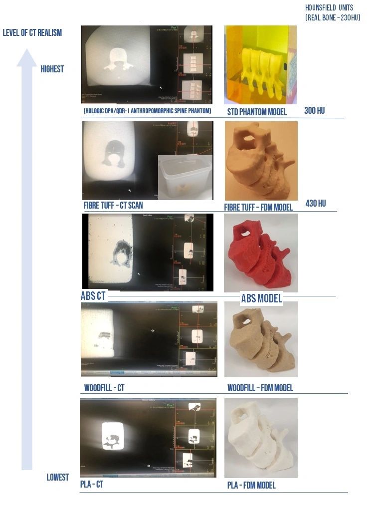 3D Printing, Biocompatible material, Bone Models - FibreTuff