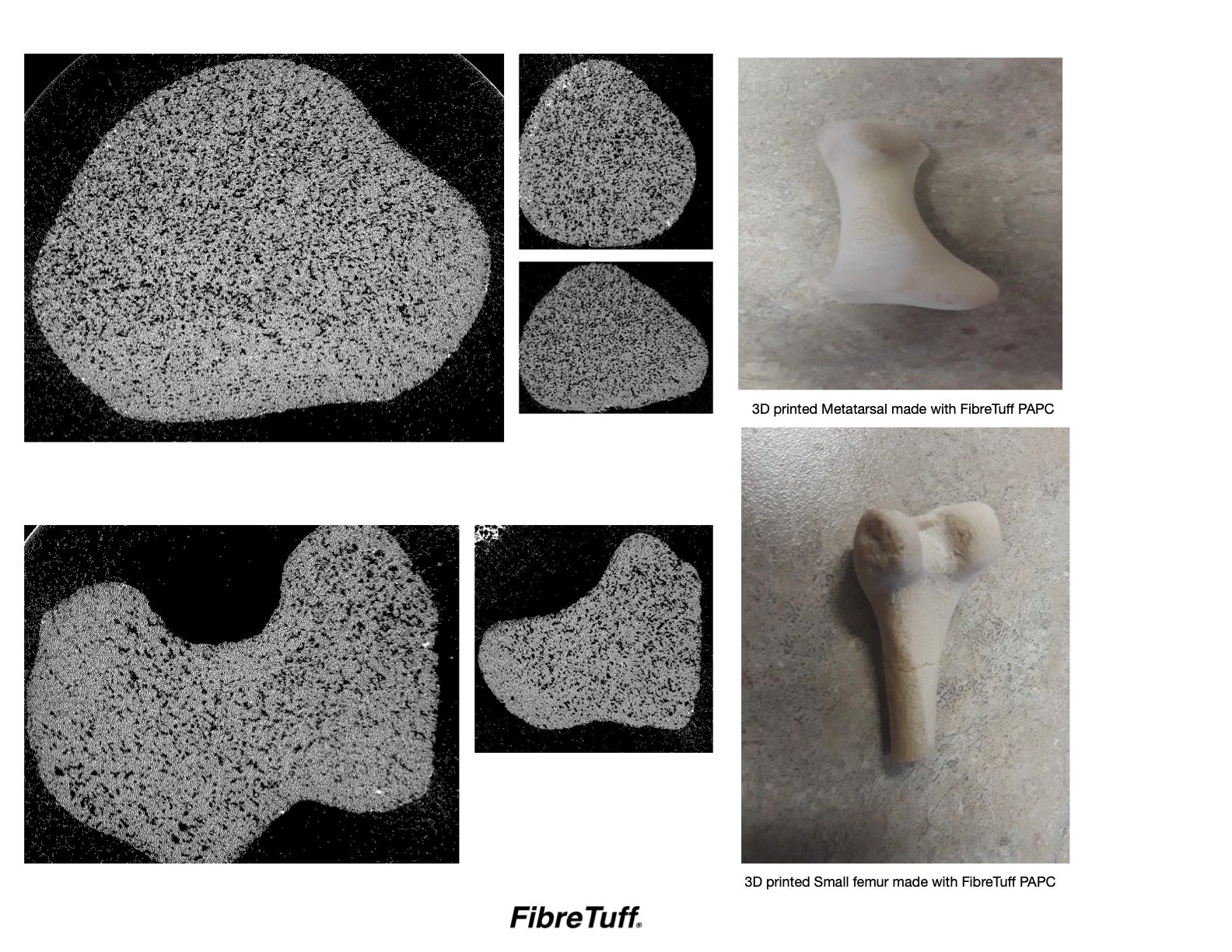 3D Printed Bone showing a NonBinary Radiographic Image
