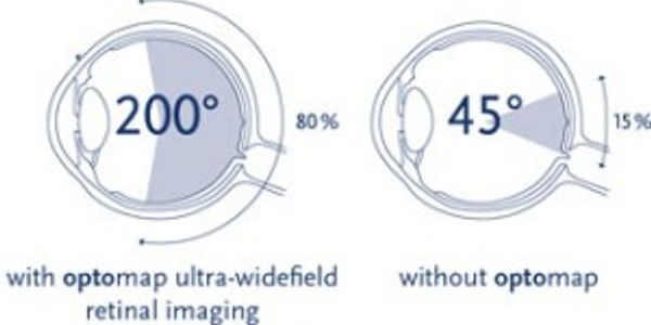 Dr Tracy Tate - Optometry - Dayton, Ohio