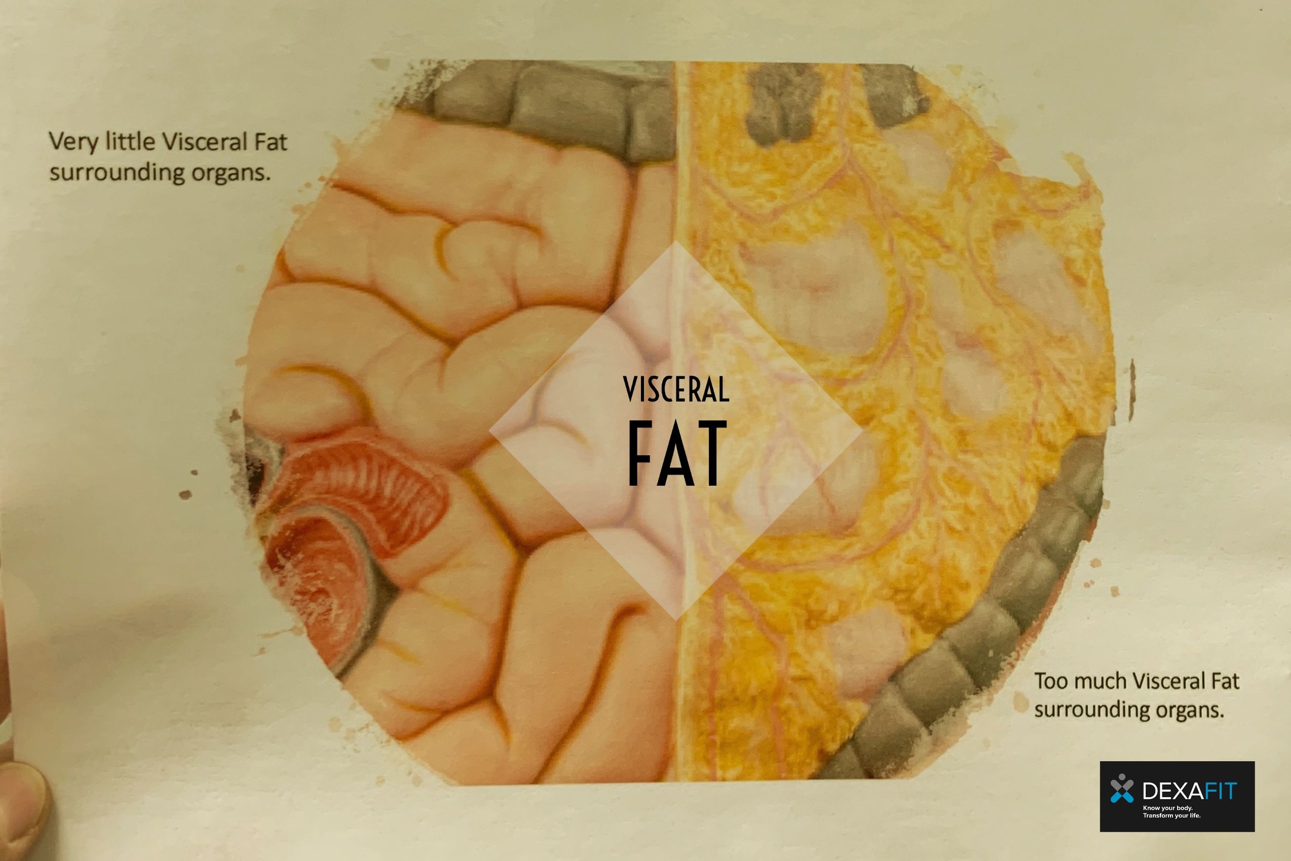 Internal Fat