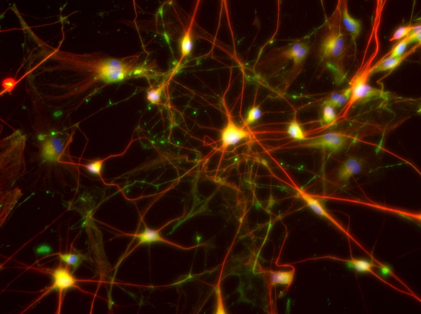 Cell Reprogramming & Therapeutics LLC