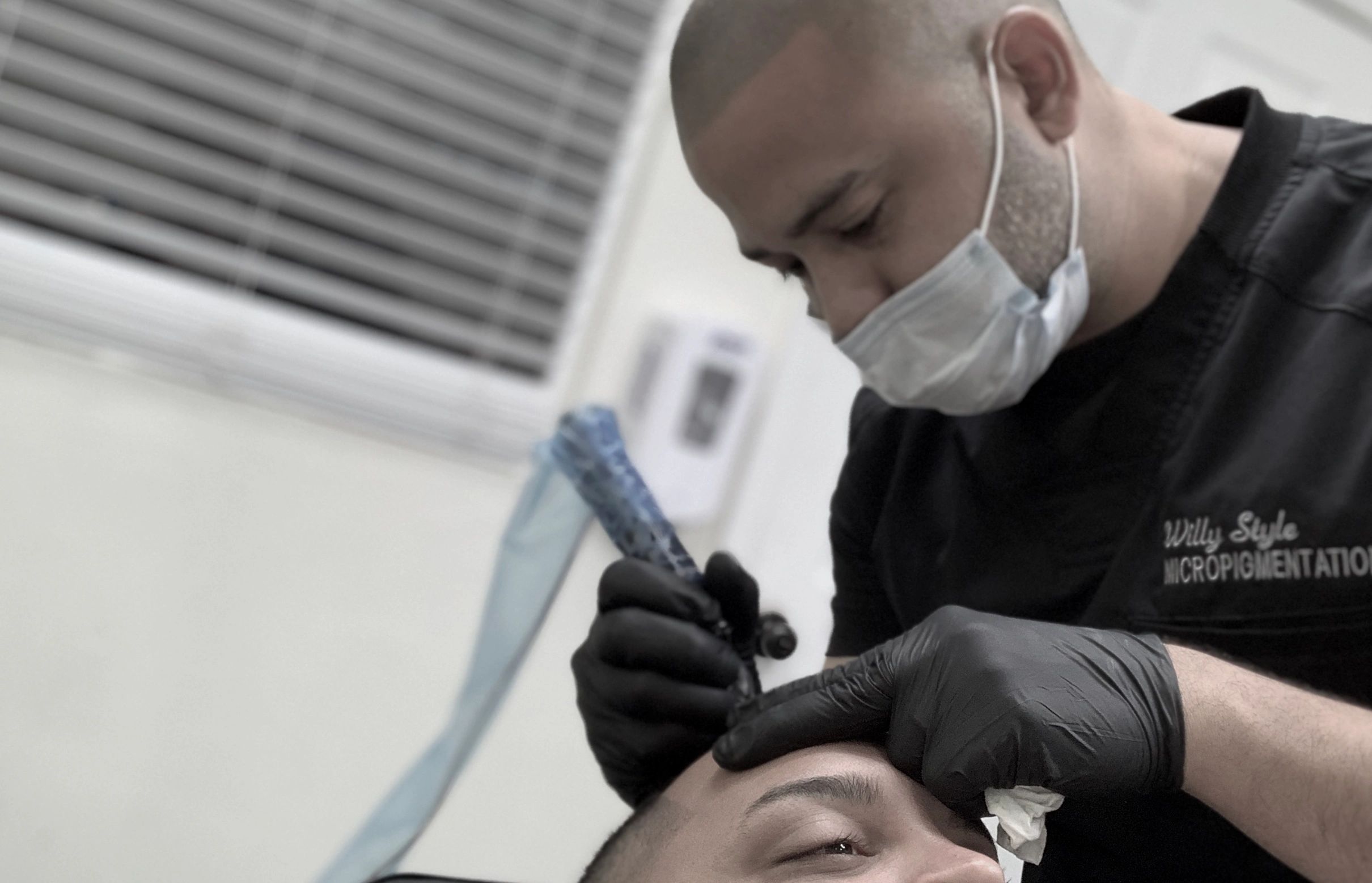 Scalp Micropigmentation - WILLY STYLE SMP