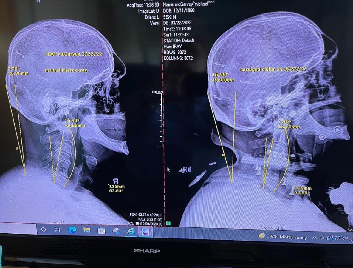 Cervigard Case of the Month