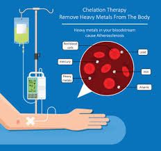 What is Chelation Therapy?