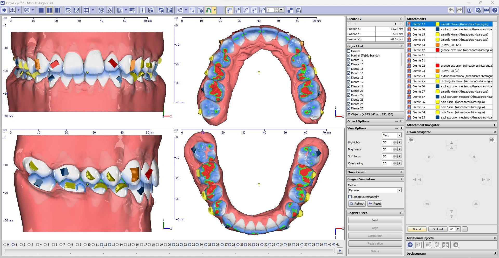 Predict Smile - Clear Aligner Consulting Services, Clear Aligner Design