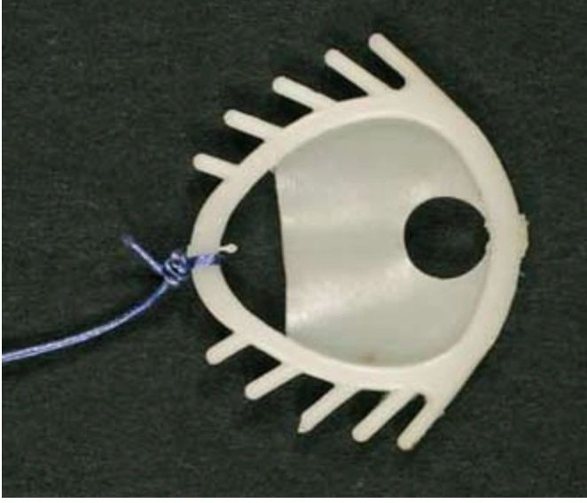 La historia del Dalkon Shield