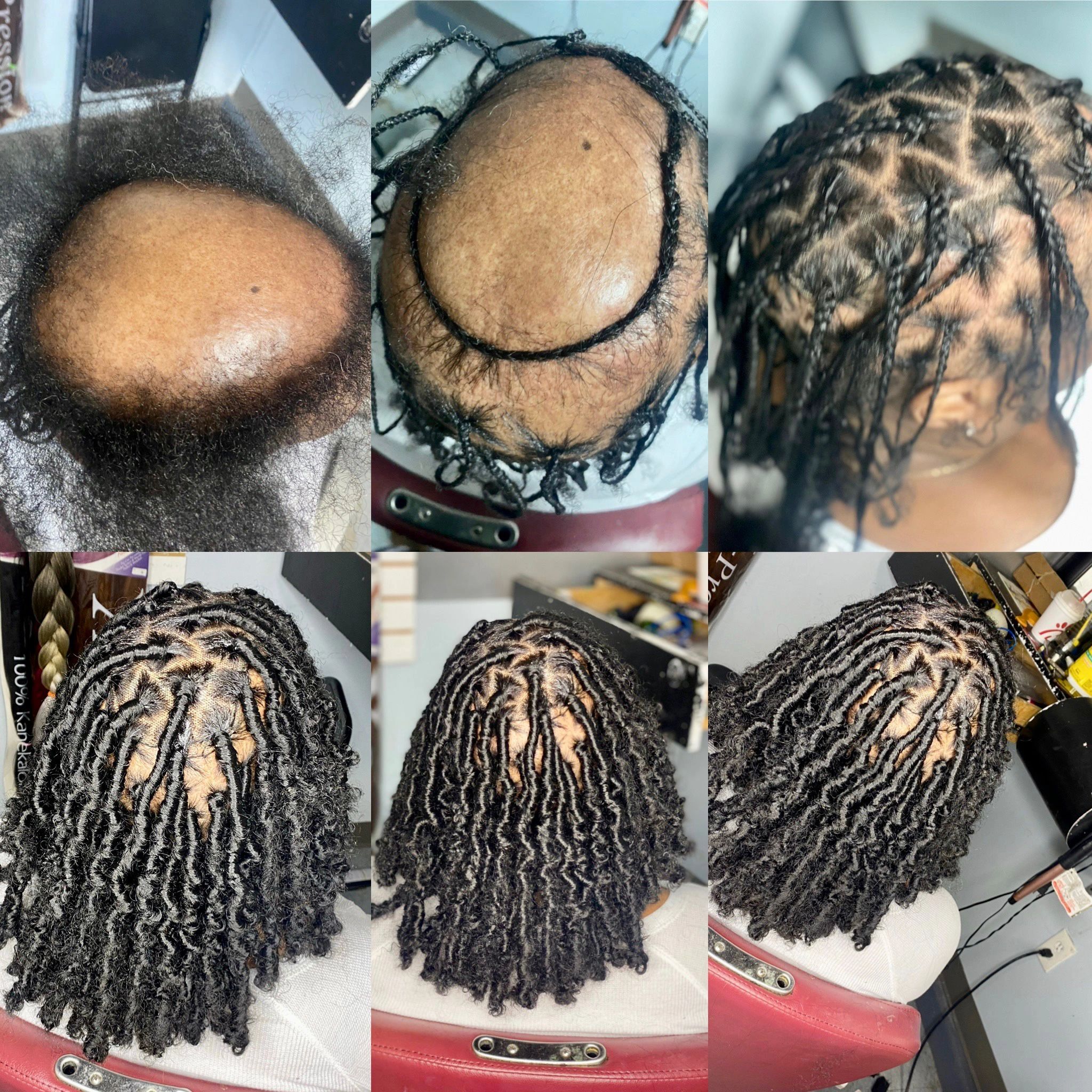 HAIRLOSS/Alopecia butterfly locs
