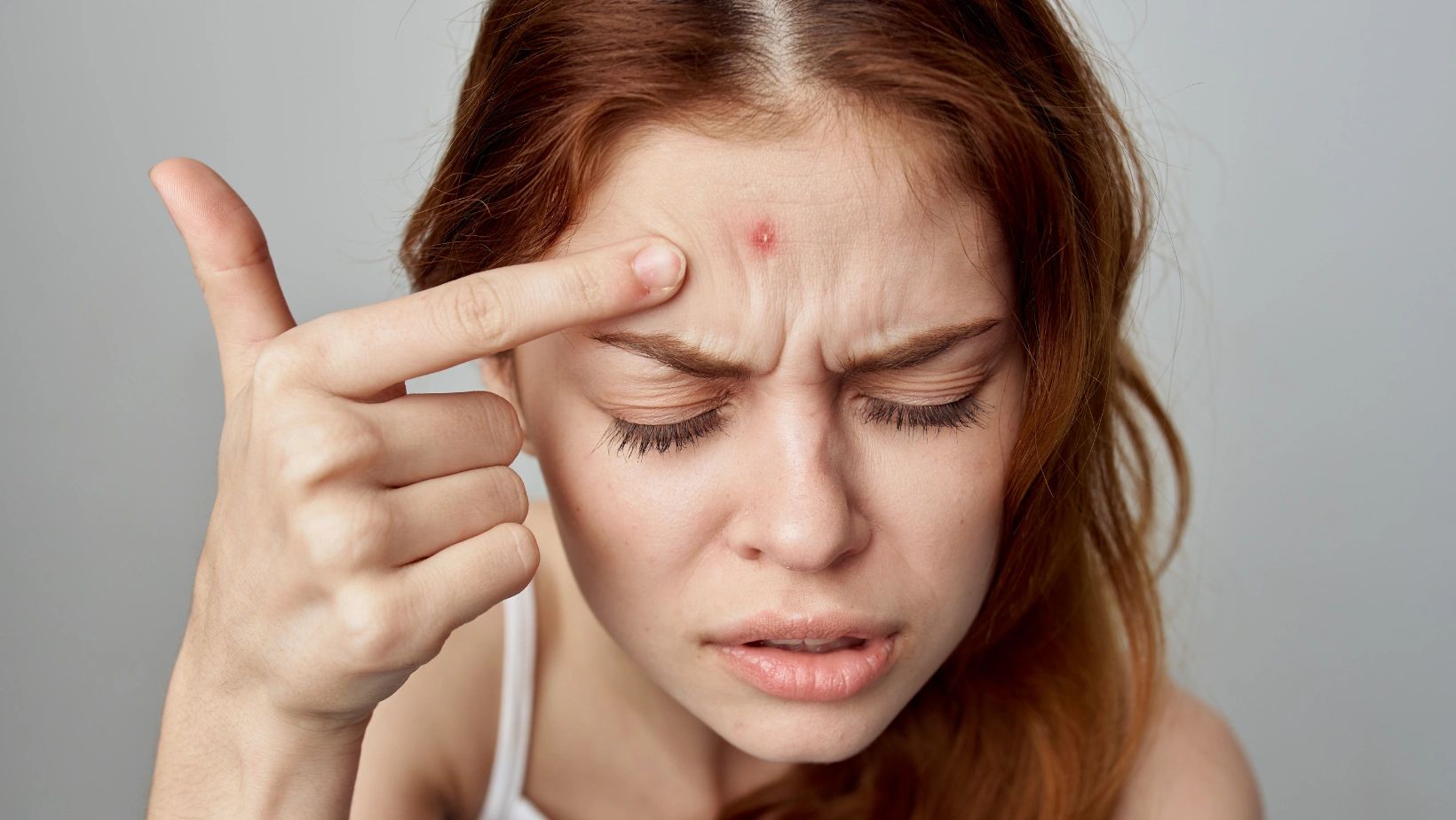 How To Treat A Large Pimple At Home