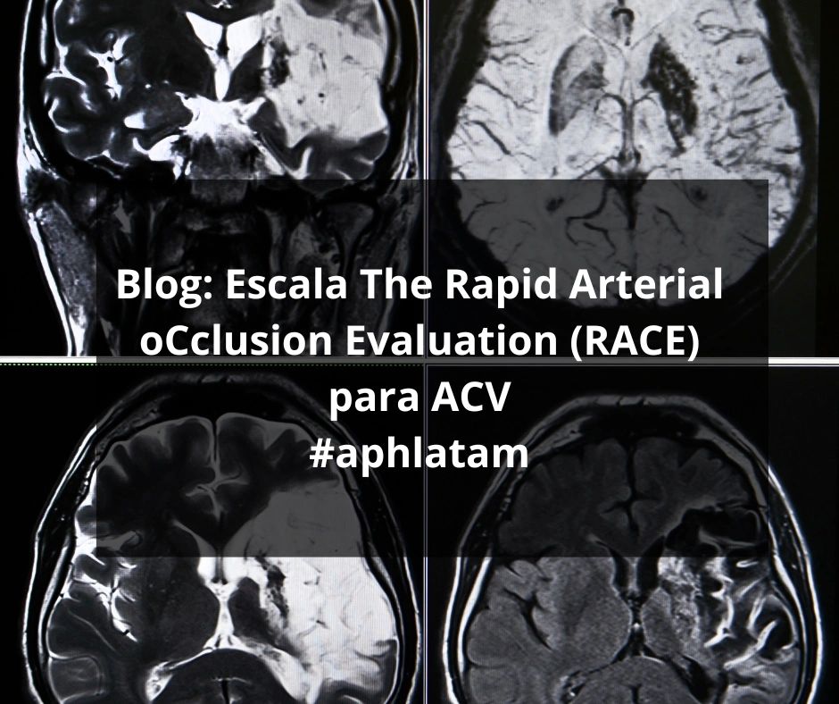 Stroke escala prehospitalaria RACE