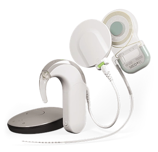 Cochlear Implants | hearingsv.com
