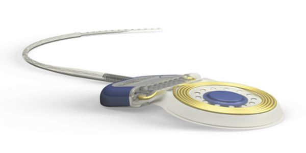 Cochlear Implants | hearingsv.com