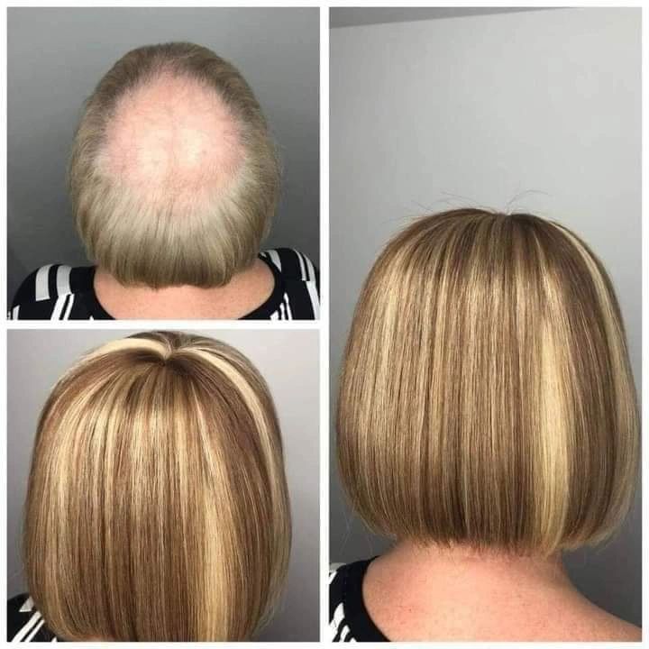 NEW LACE 6X6 CLOSURE